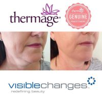 Adelaide's Beauty, Laser & Cosmetic Clinic