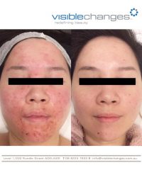 Adelaide's Beauty, Laser & Cosmetic Clinic