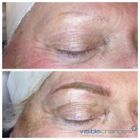 Adelaide's Beauty, Laser & Cosmetic Clinic