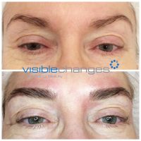 Adelaide's Beauty, Laser & Cosmetic Clinic