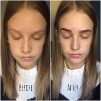Adelaide's Beauty, Laser & Cosmetic Clinic