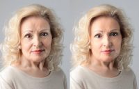 Adelaide's Beauty, Laser & Cosmetic Clinic