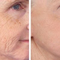 Adelaide's Beauty, Laser & Cosmetic Clinic